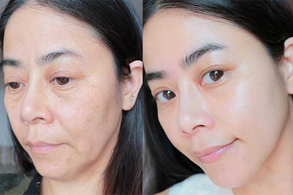 Surgery Won't Fix Your Disease! Here's How to Get Rid of Severe Knee ...